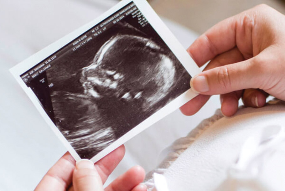 Wellbeing Baby Growth Scan | Private Ultrasound Scans London
