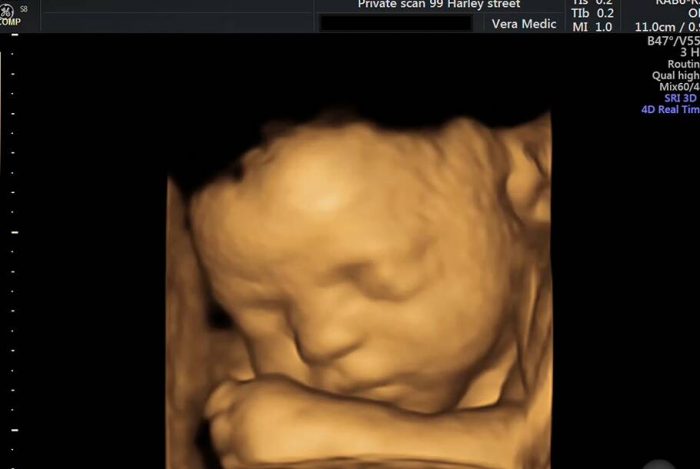 4D Baby Growth and Doppler Scan | Private Ultrasound Scans London