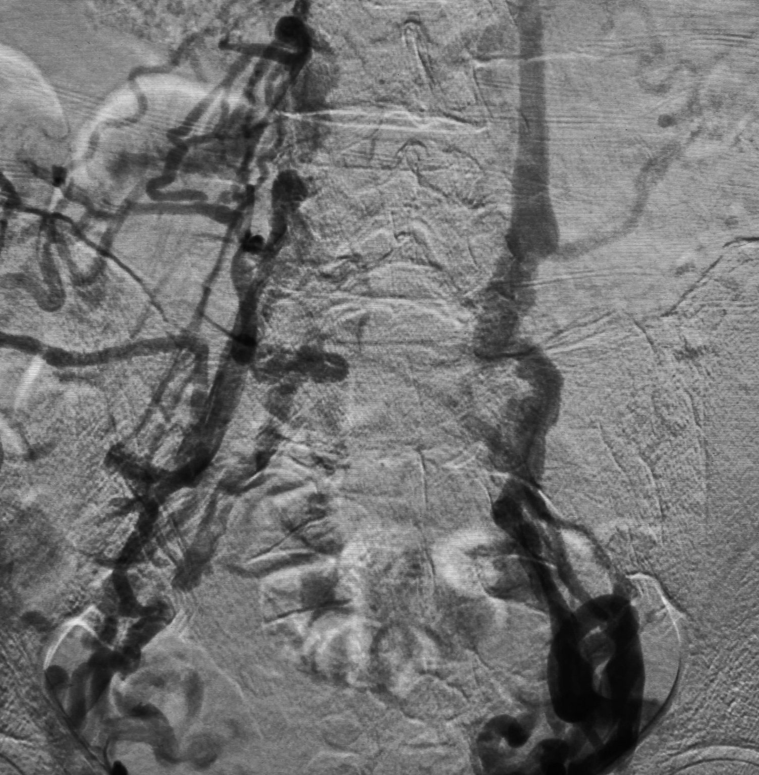 DVT Scan (Deep Vein Thrombosis) | Private Ultrasound Scans London